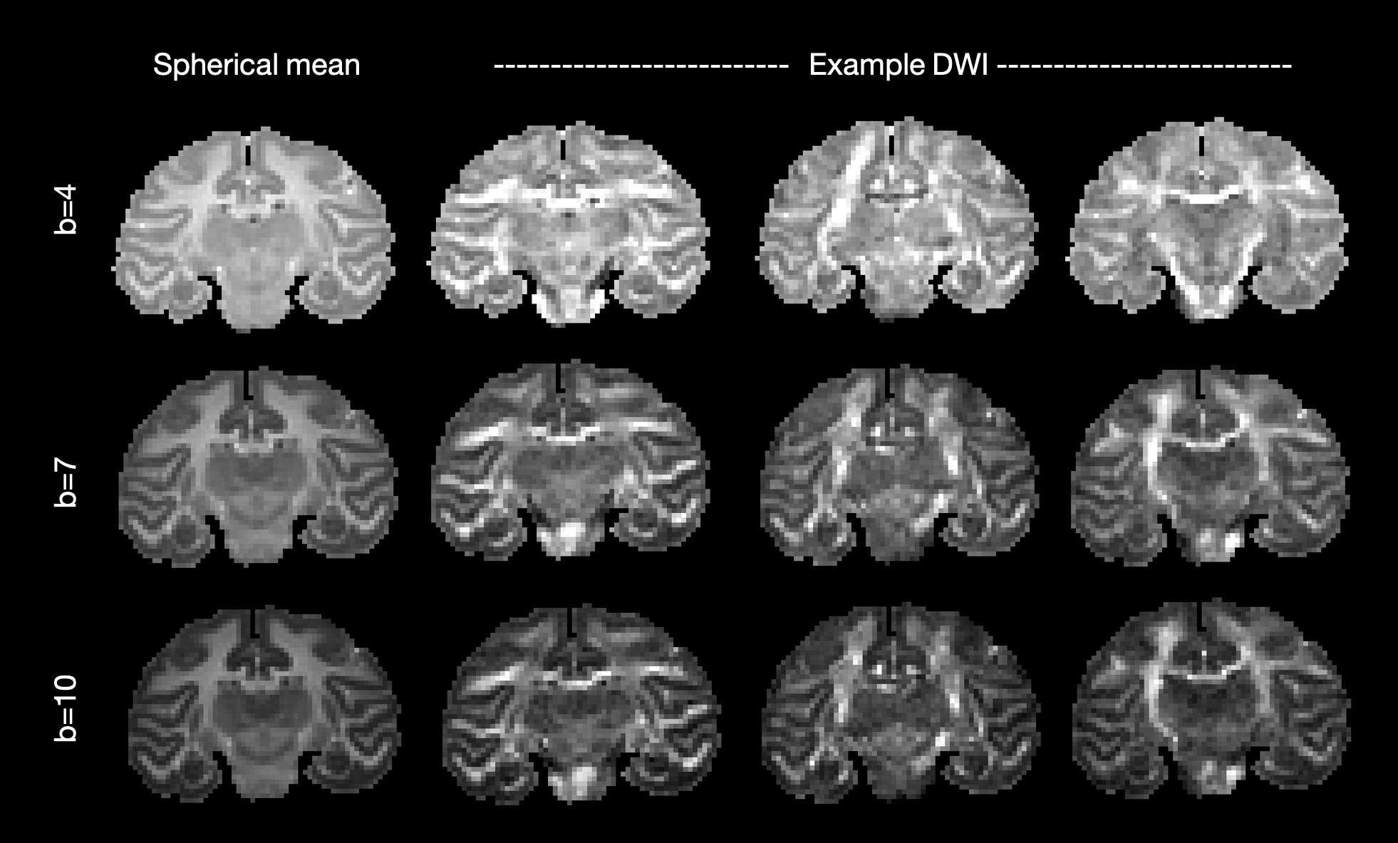 Postmortem MRI — The BigMac Dataset: Documentation 3.7.0 documentation