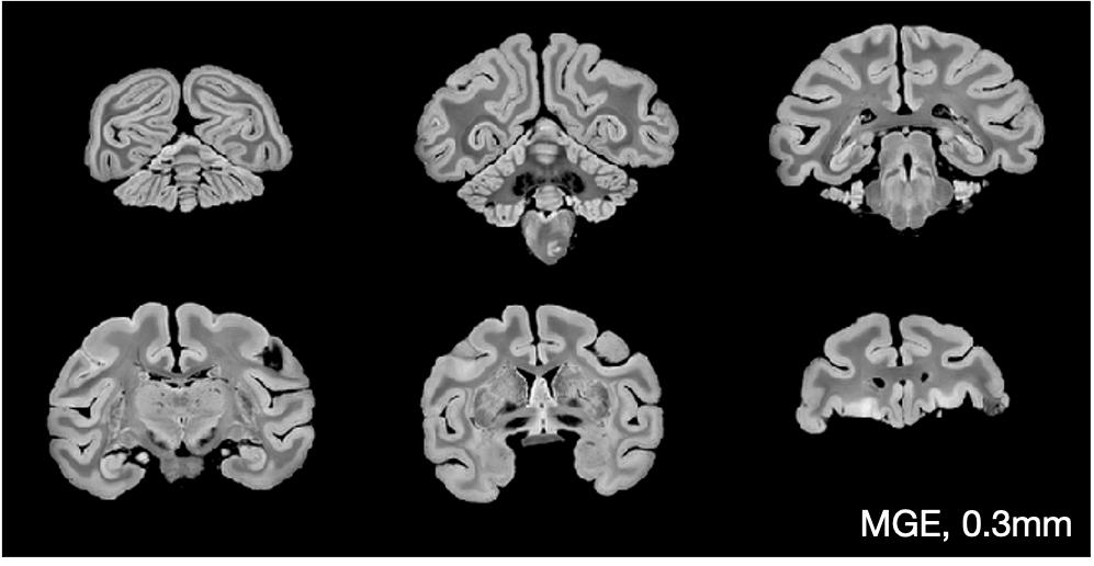Postmortem MRI — The BigMac Dataset: Documentation 3.7.0 documentation