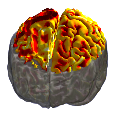 3D view — FSLeyes documentation