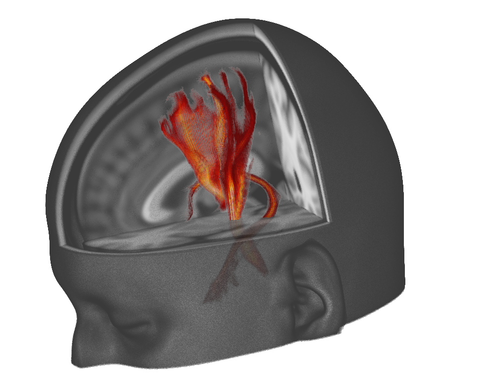 3D view — FSLeyes documentation