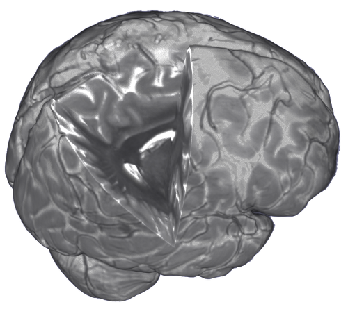 3D view — FSLeyes documentation