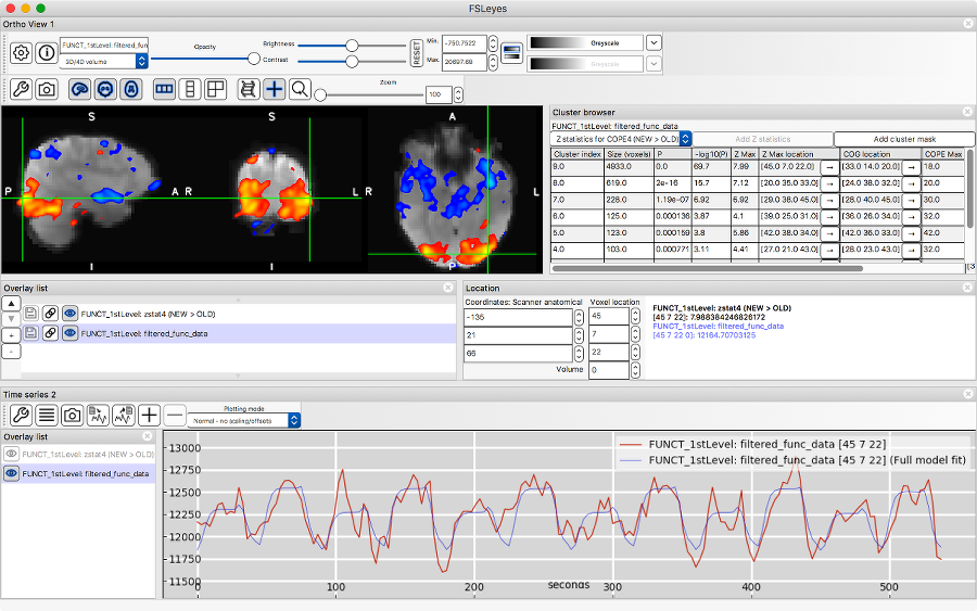 Viewing FEAT analyses — FSLeyes documentation