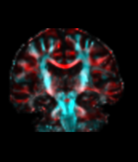 Overlays — FSLeyes documentation