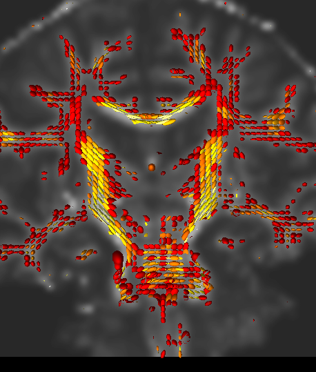 Overlays — FSLeyes documentation