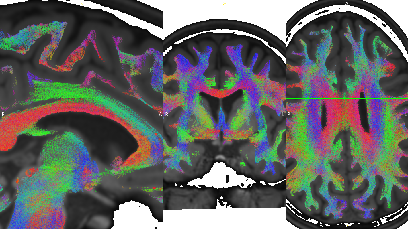 Overlays — FSLeyes documentation