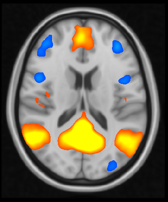 Overlays — FSLeyes documentation