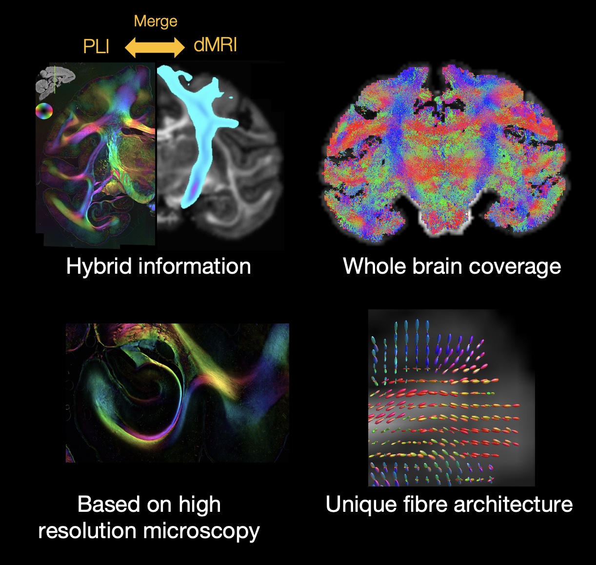 Welcome to the dMRI-microscopy hybrid tractography tutorial — The ...