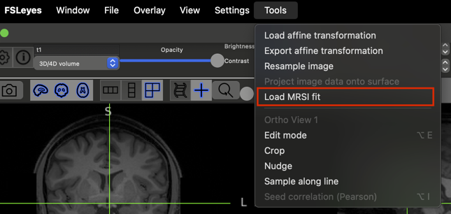 Loading MRSI Results — fsleyes-plugin-mrs 0.1.4 documentation